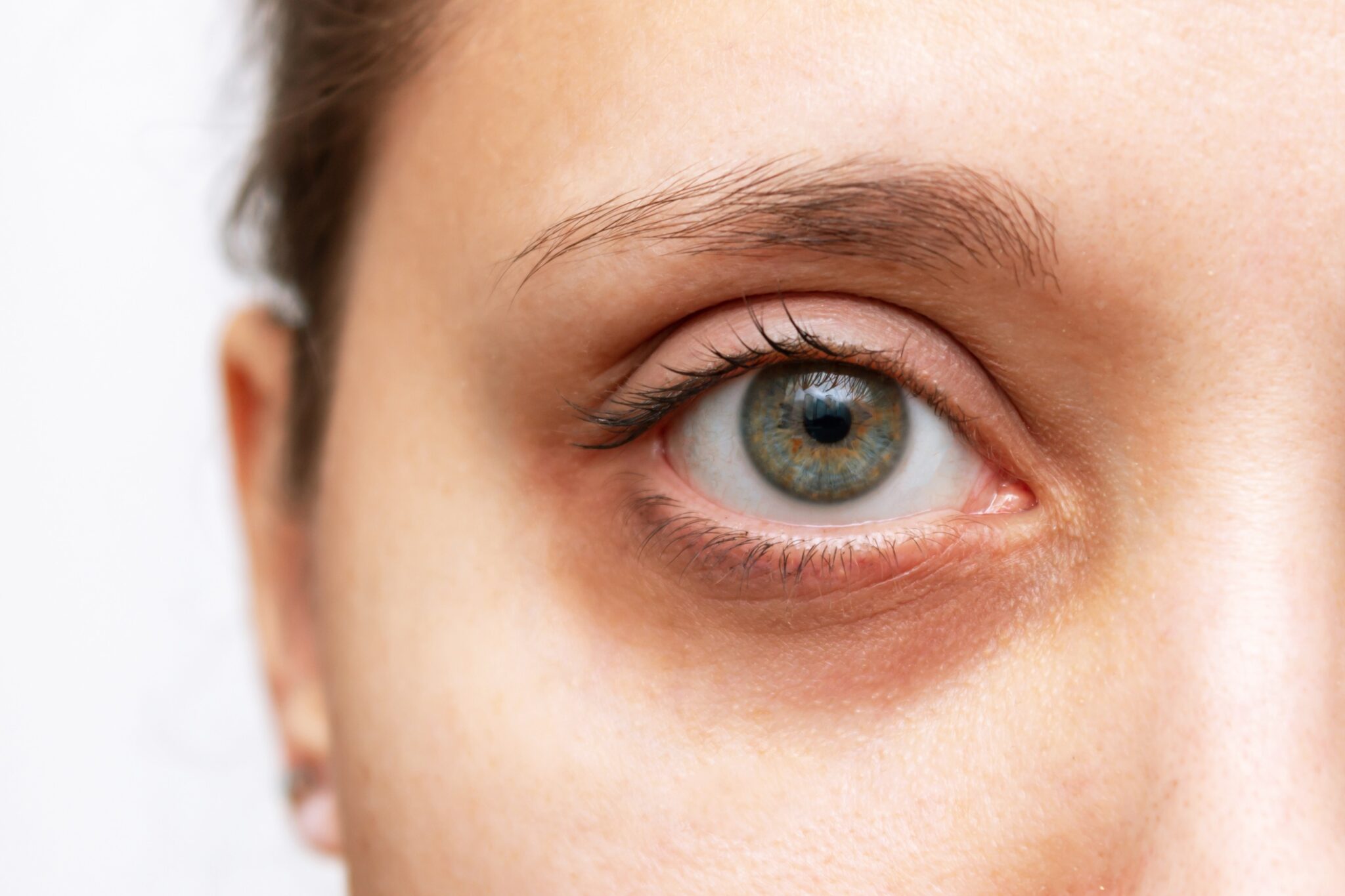 Retinal Diseases and Treatments | Sabates Eye Centers